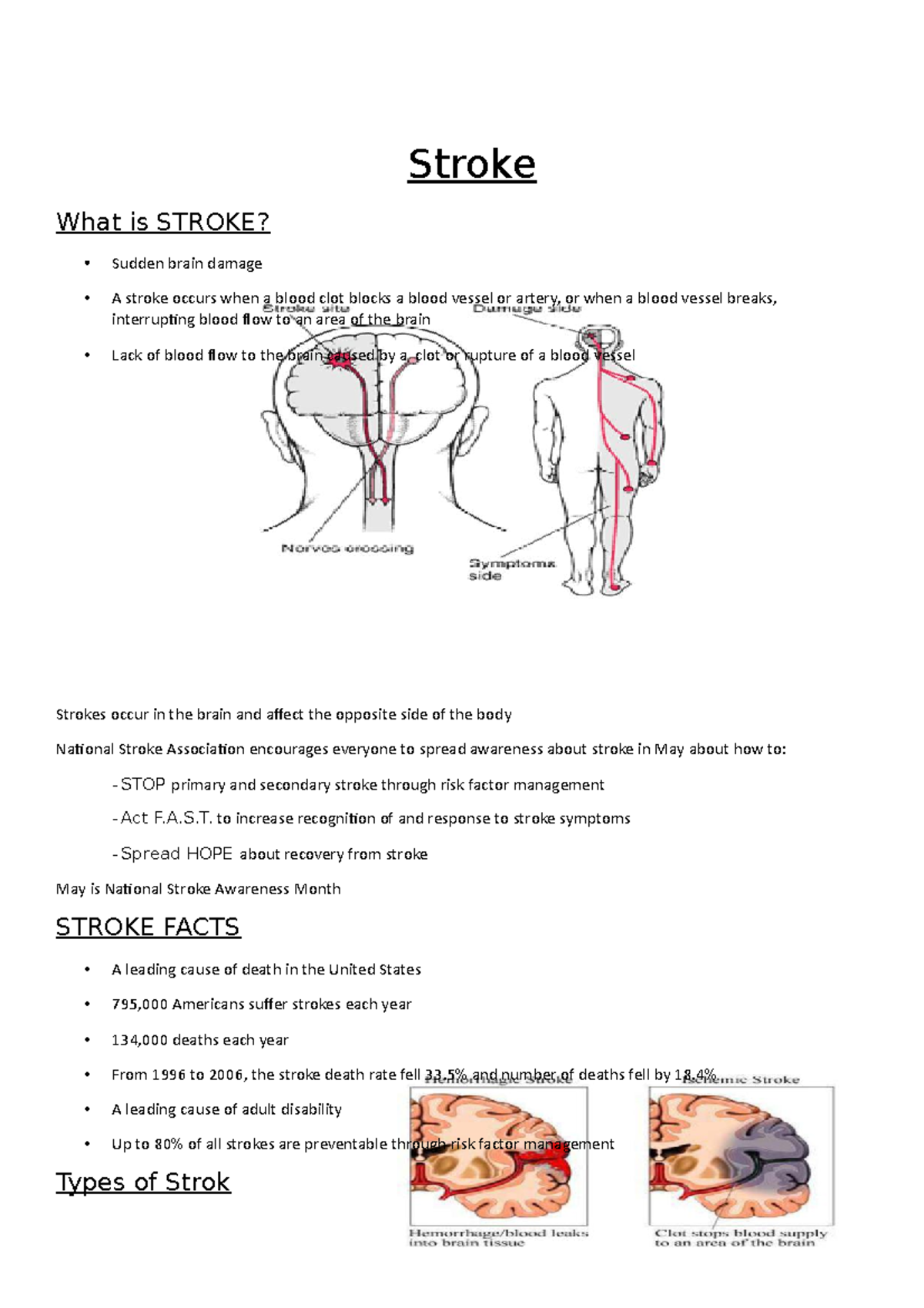 Chapter - 36 Stroke - Stroke What is STROKE? Sudden brain damage A ...