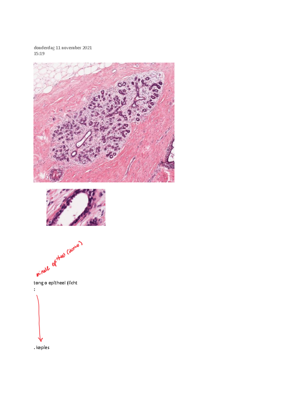 Pathologie mamma - donderdag 11 november 2021 15: tong o epitheel ...