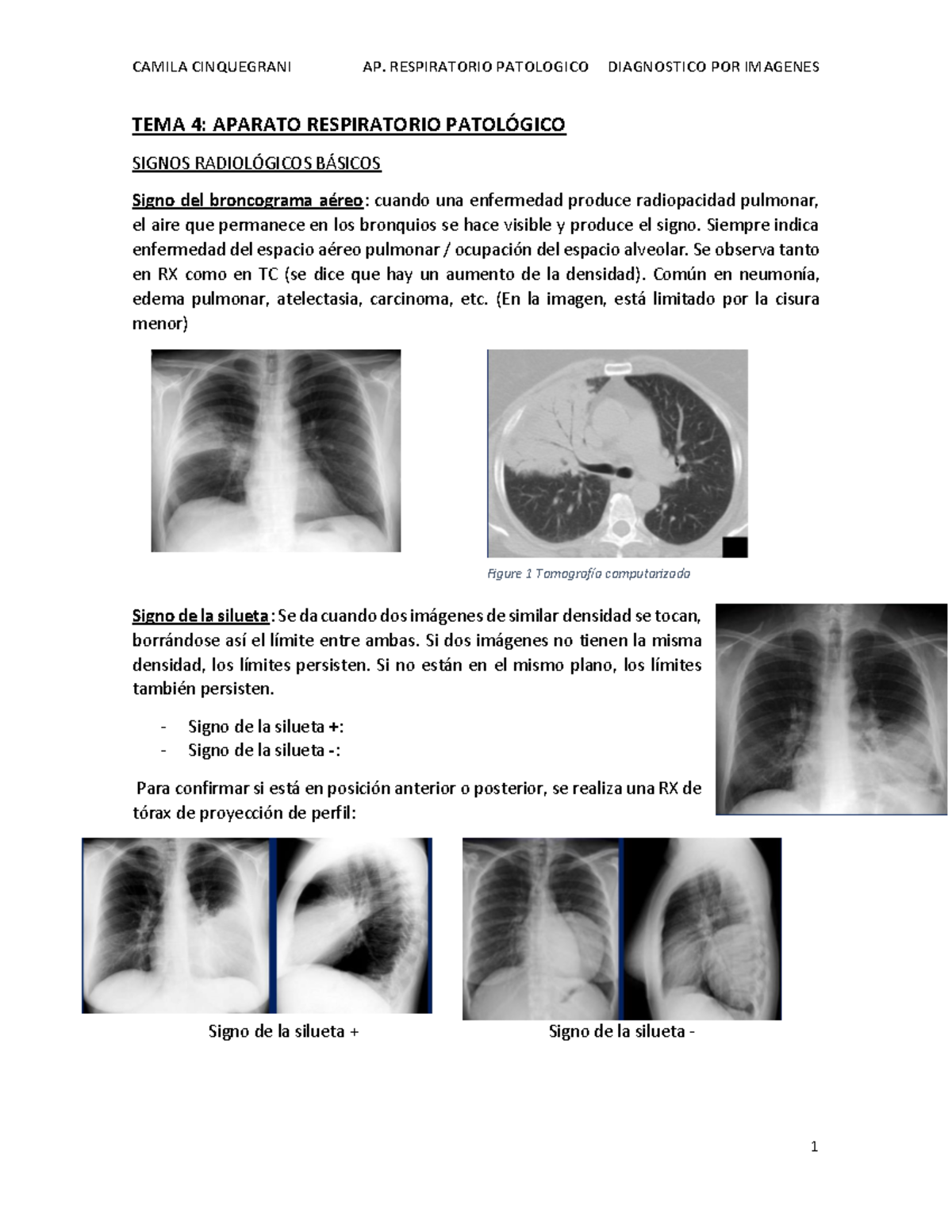 TEMA 4 AP RESP Patologico - TEMA 4: APARATO RESPIRATORIO PATOLÓGICO ...