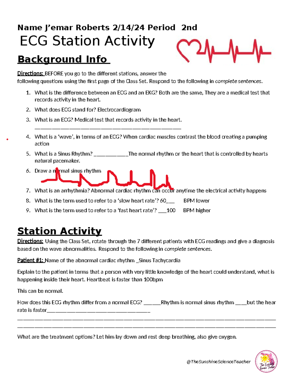 ECG Station Activity - Cheat sheet - Name J’emar Roberts 2/14/24 Period ...