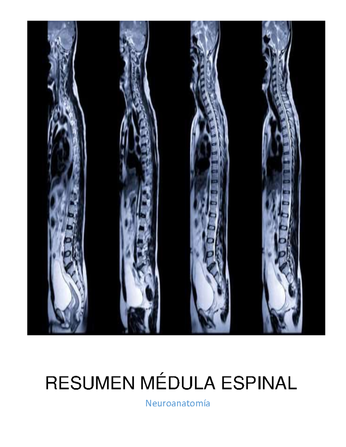 Medula Espinal - neuroanatomia - RESUMEN MÉDULA ESPINAL Neuroanatomía ...