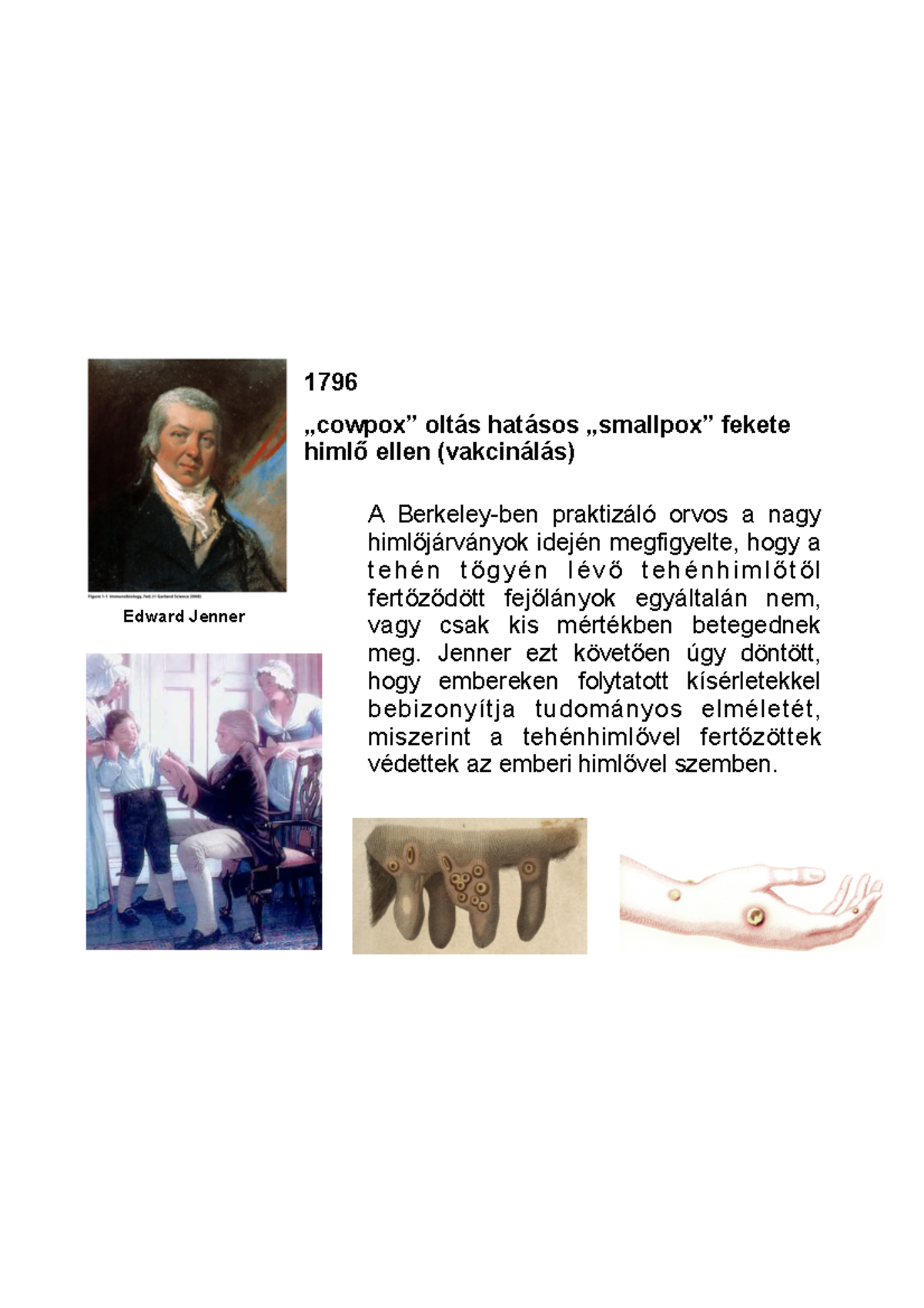 Immunologia levelező 2022 12 - Edward Jenner 1796 „cowpox” oltás ...