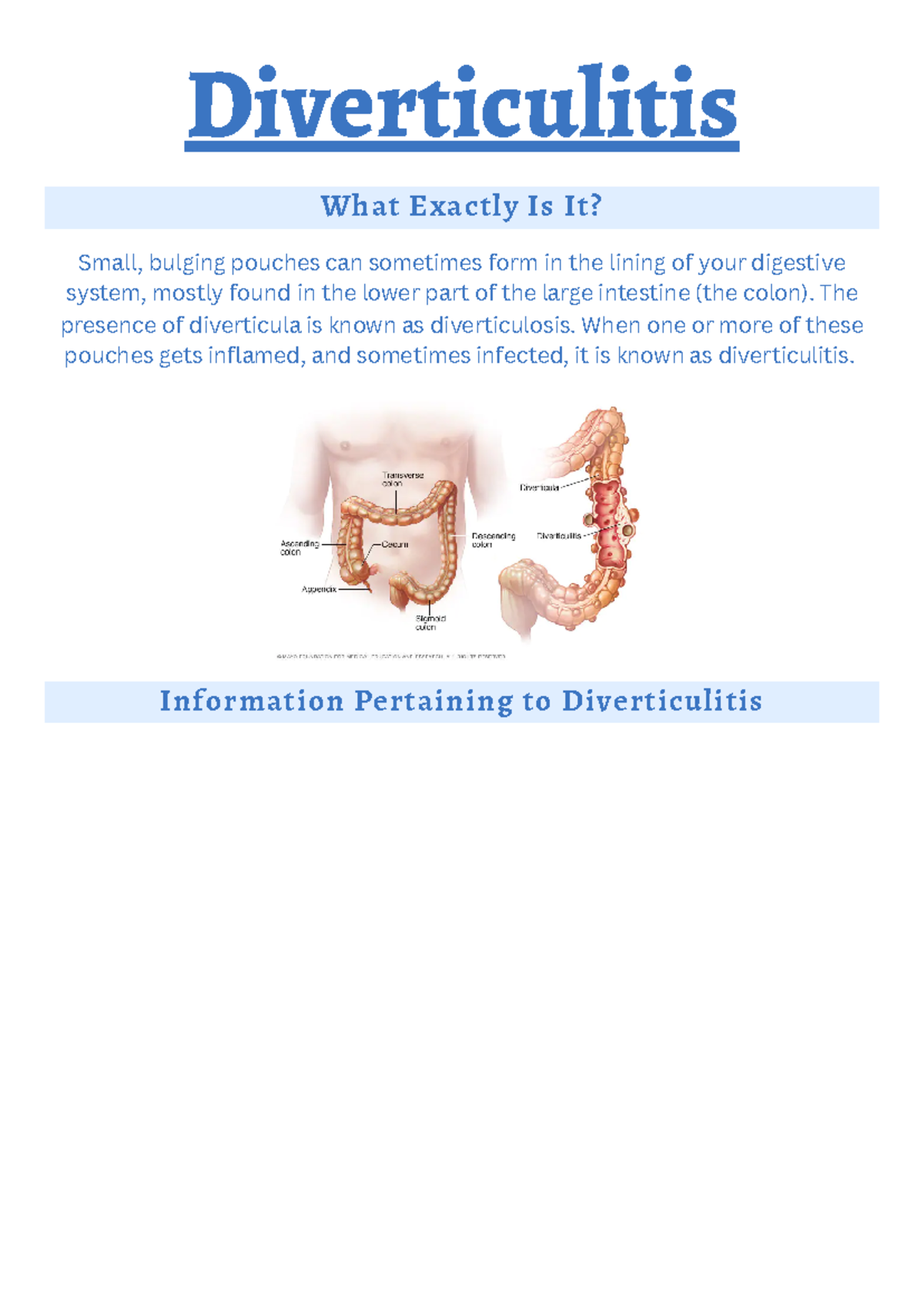 Diverticulitis Poster MDC II - Diverticulitis Small, bulging pouches ...