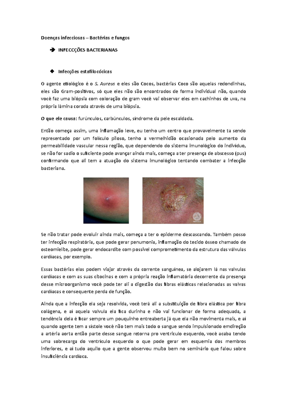 Doenças infecciosas - Bacterias E Fungos - Doenças infecciosas ...