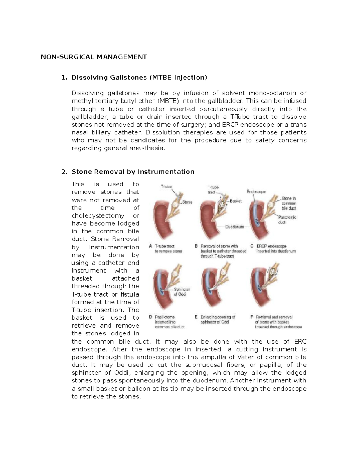Colelithiasis-medical-management - NON-SURGICAL MANAGEMENT Dissolving ...