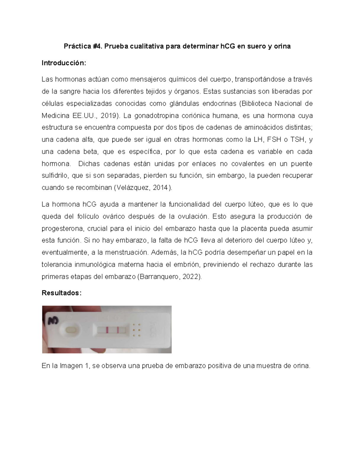 Post Laboratorio P4 - Medición de hCG en suero y orina - Práctica #4 ...