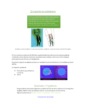 Tecnicas de Obturacion - Técnicas para la Obturacion del conducto ...