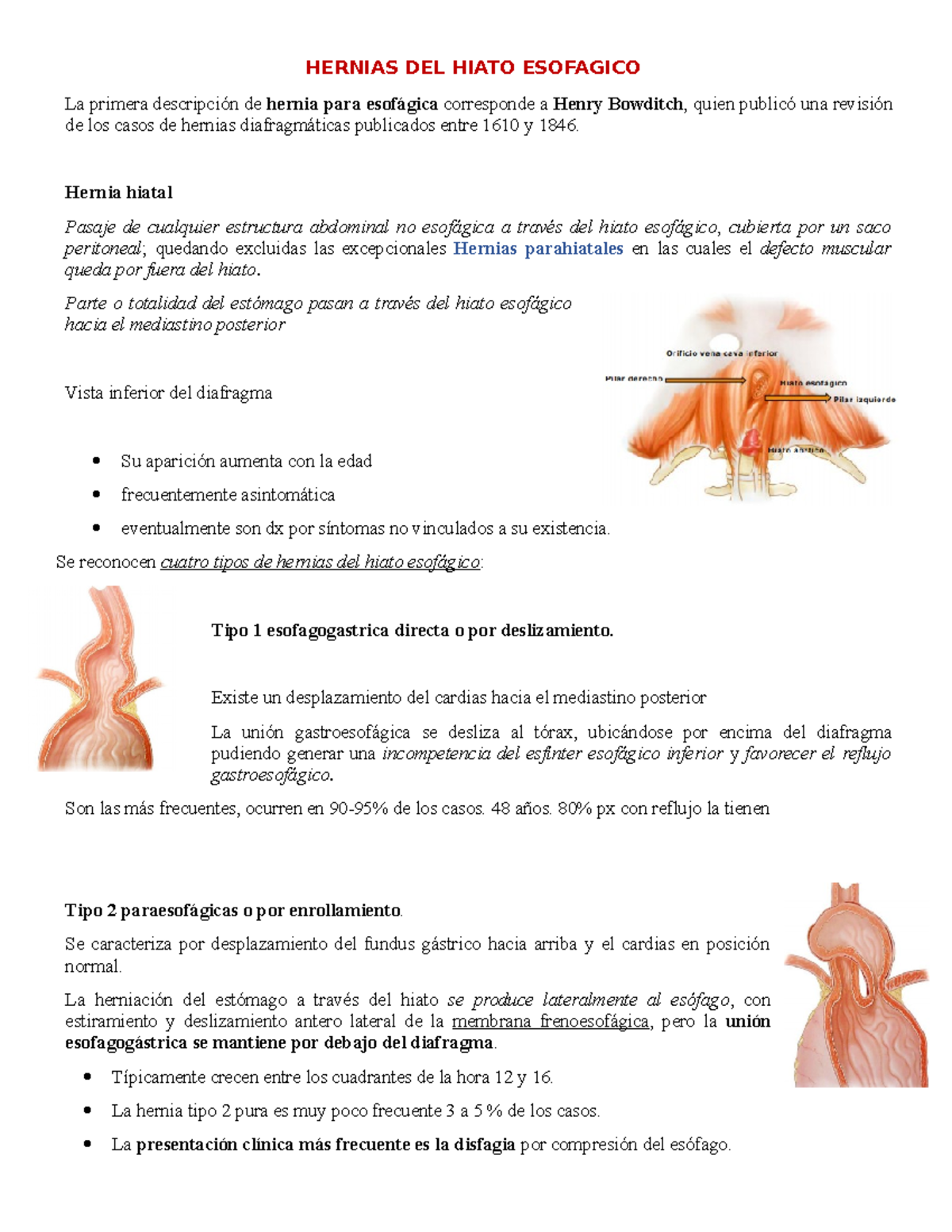 Hernias de Hiato Esofágico - HERNIAS DEL HIATO ESOFAGICO La primera ...