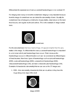 Consort-SPI Checklist - Evidence Based Practice - UiTM - Studocu