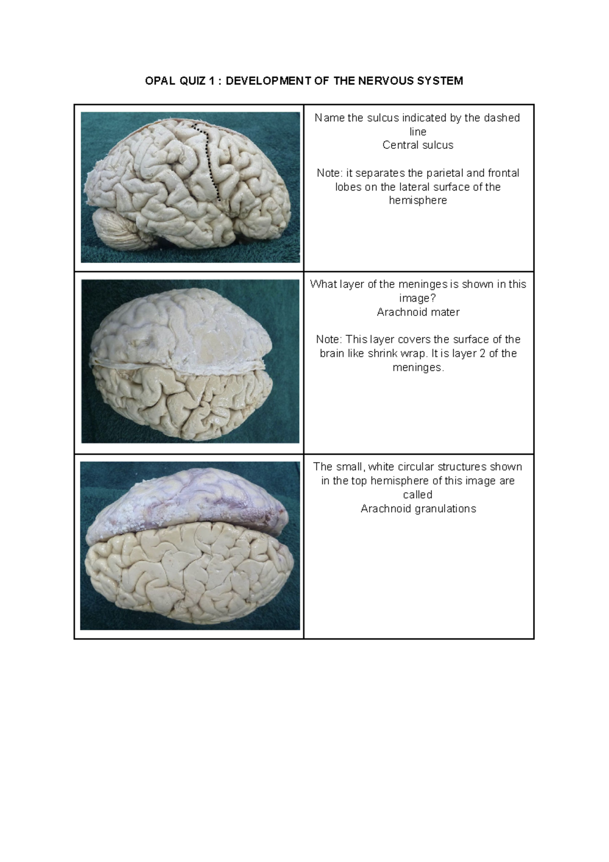 Neuroanatomy OPAL Quizzes Practicals - OPAL QUIZ 1 : DEVELOPMENT OF THE ...