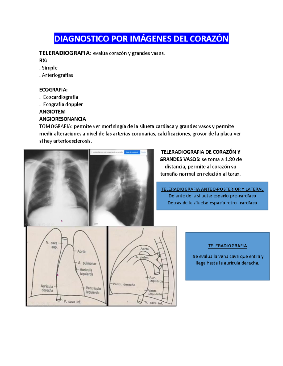 Diagnostico POR Imágenes DEL Corazón - Radiologia y diagnostico por ...