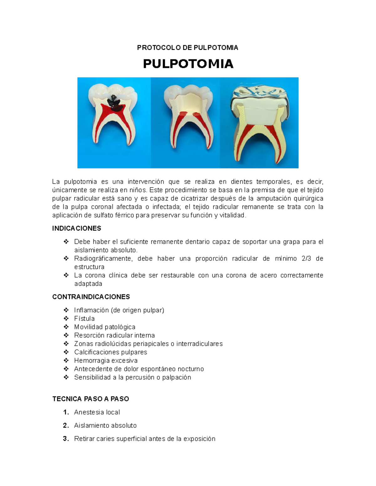 Protocolo pulpotomia - PROTOCOLO DE PULPOTOMIA PULPOTOMIA La pulpotomia es una intervención que ...