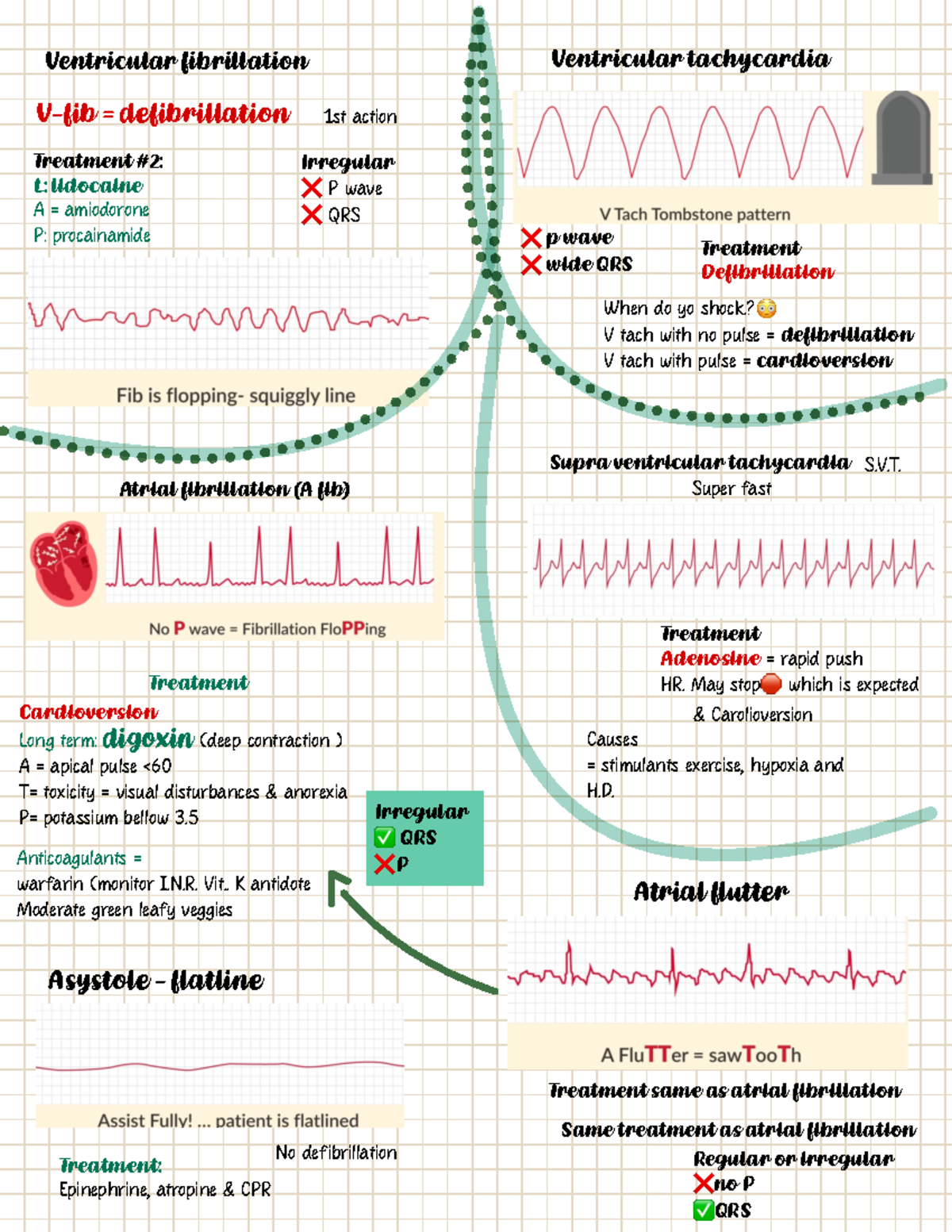 Concepts II Med Surg - Ventricular fibrillation V-fib = defibrillation ...