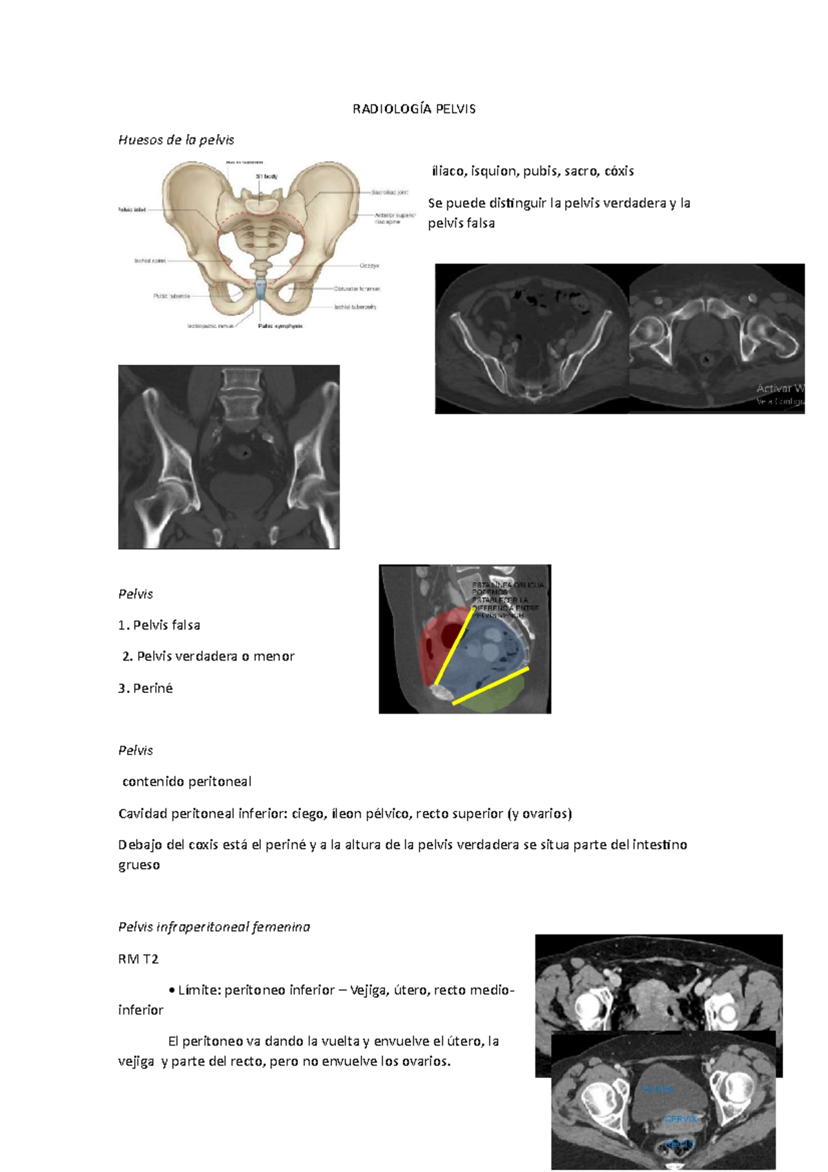 Radiología Pelvis - jajaja - RADIOLOGÍA PELVIS Huesos de la pelvis ...