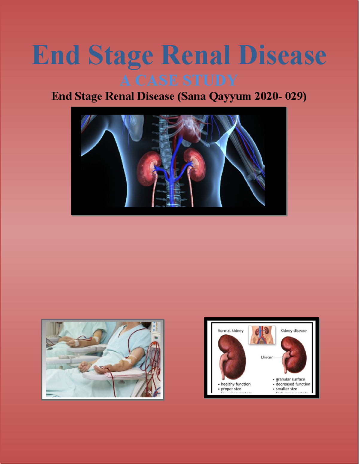 202002 9 Sana-Qayyum ESRD - y End Stage Renal Disease A CASE STUDY End ...