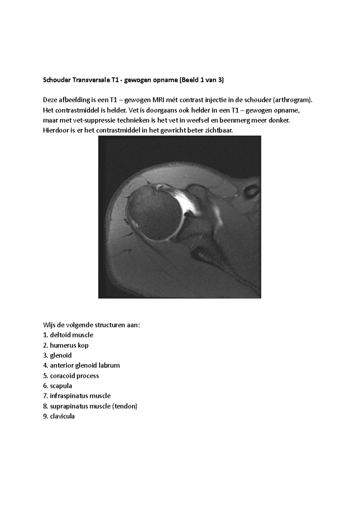 Anatomie MRI1 - Samenvatting MRI - Schouder Transversale T1 gewogen ...