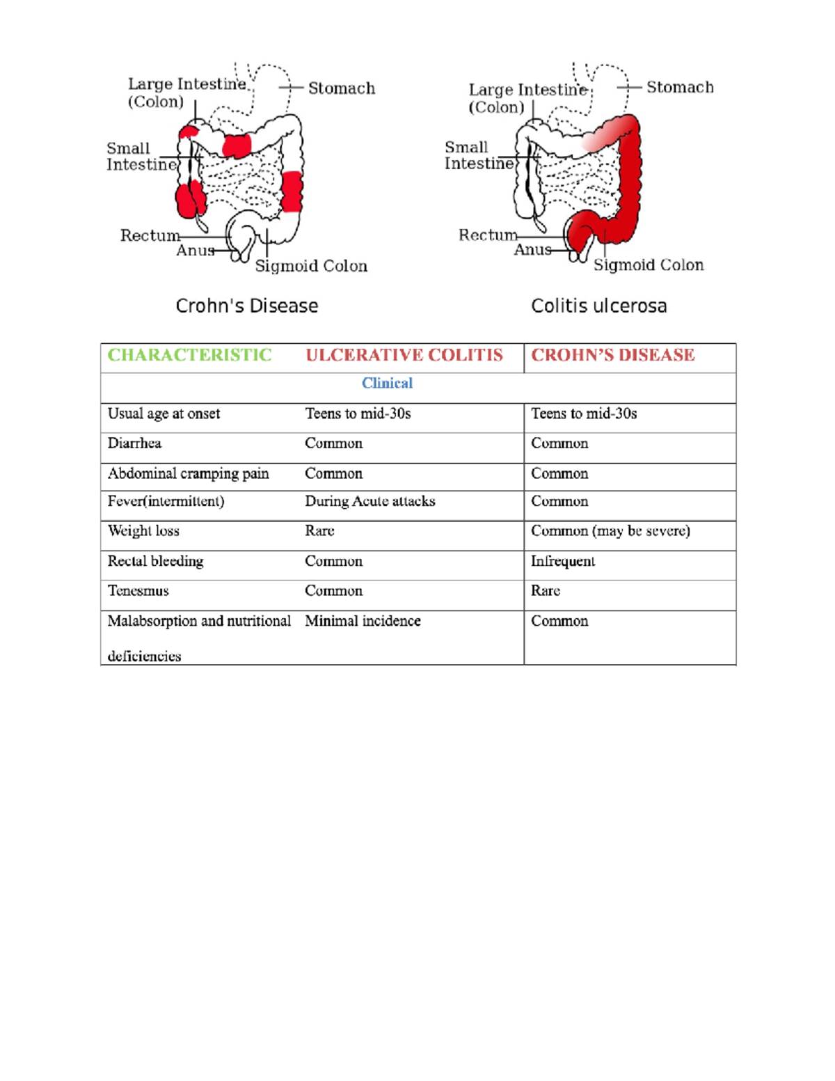 IBS comparison - Large Stomach Large Intestine Stomach (Colon) (Colon ...