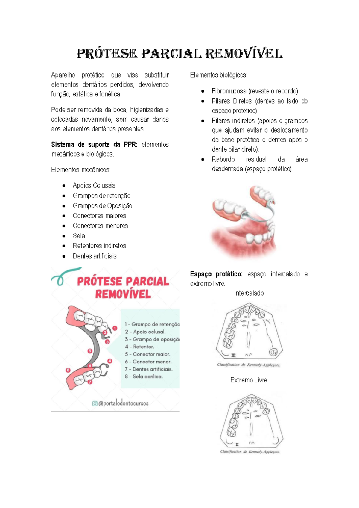 Prótese Parcial Removível - Prótese Parcial Removível Aparelho ...