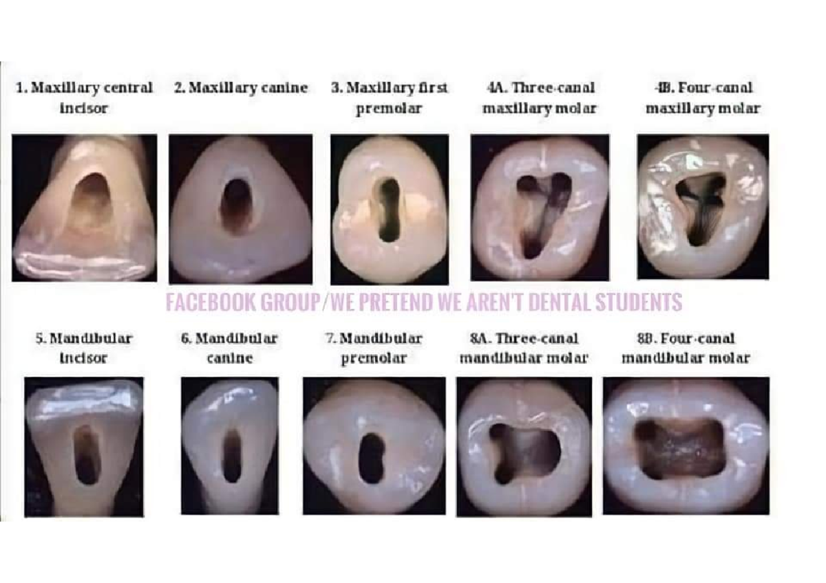 Shapes of Access Cavity & Root Canal Location - Clinical medicine - Studocu