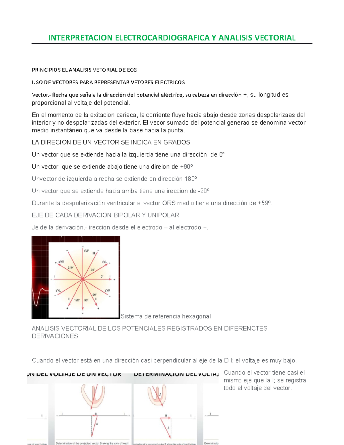 resumen de Interpretacion Electrocardiografica Y Analisis Vectorial de ...