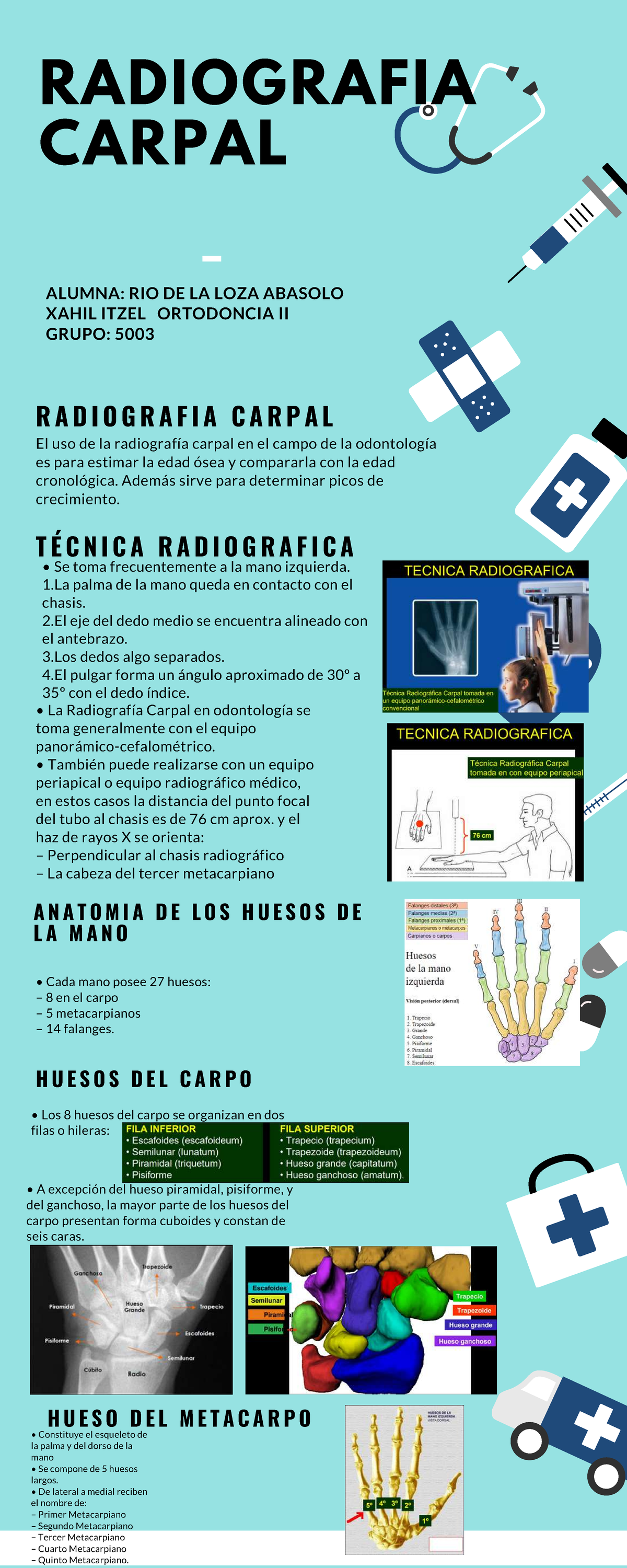 Infografia rx carpal - La Radiografía Carpal en odontología se toma ...