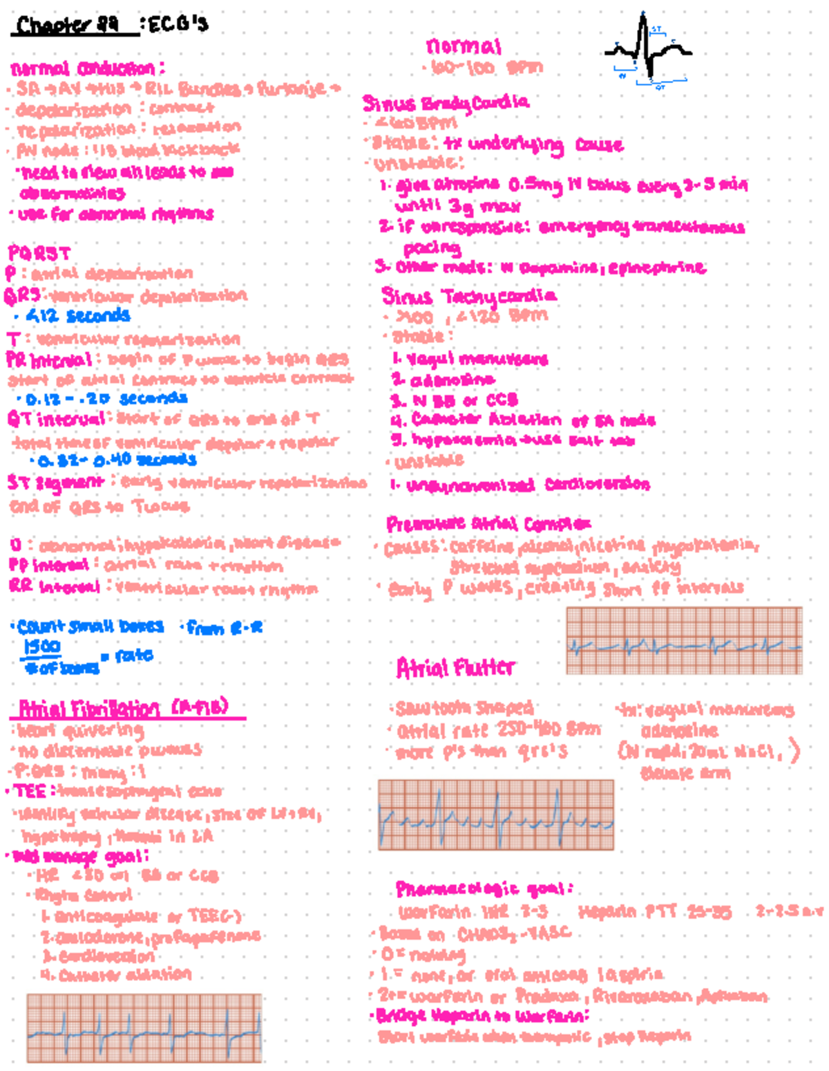 Test Study Guides - Test notes - Chapter 22 : ECG's normal : normal ...