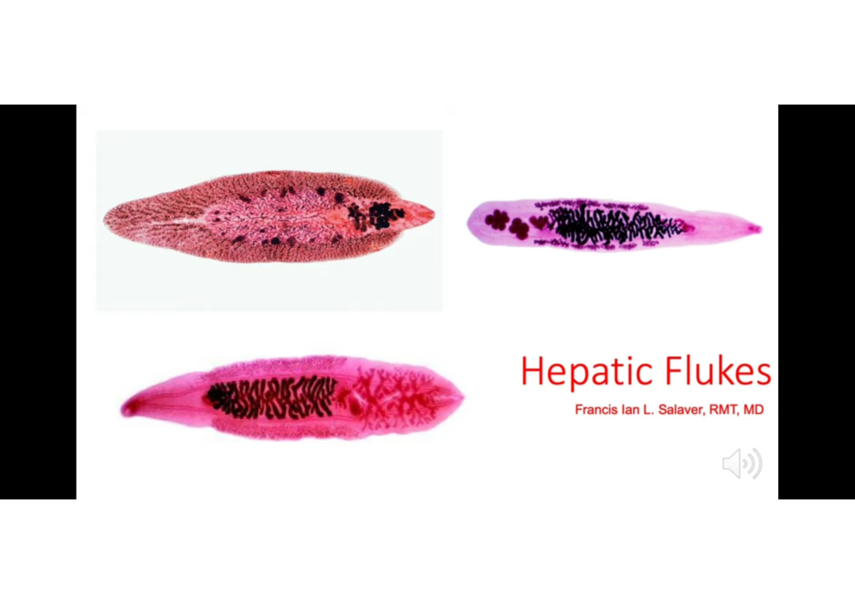 Hepatic Flukes - Summary - Internal medicine - Studocu