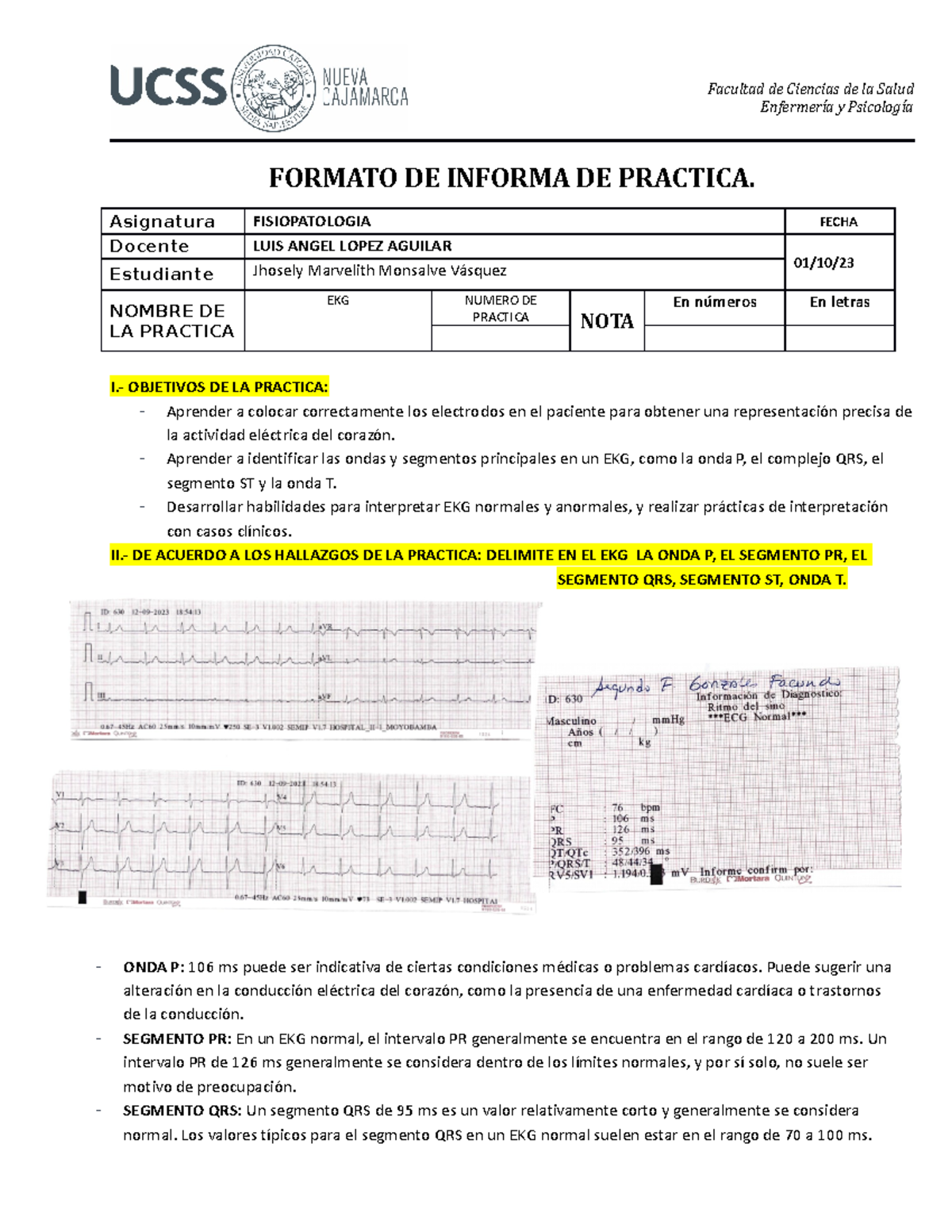 EKG Practica Informe Jhosss - Facultad de Ciencias de la Salud ...
