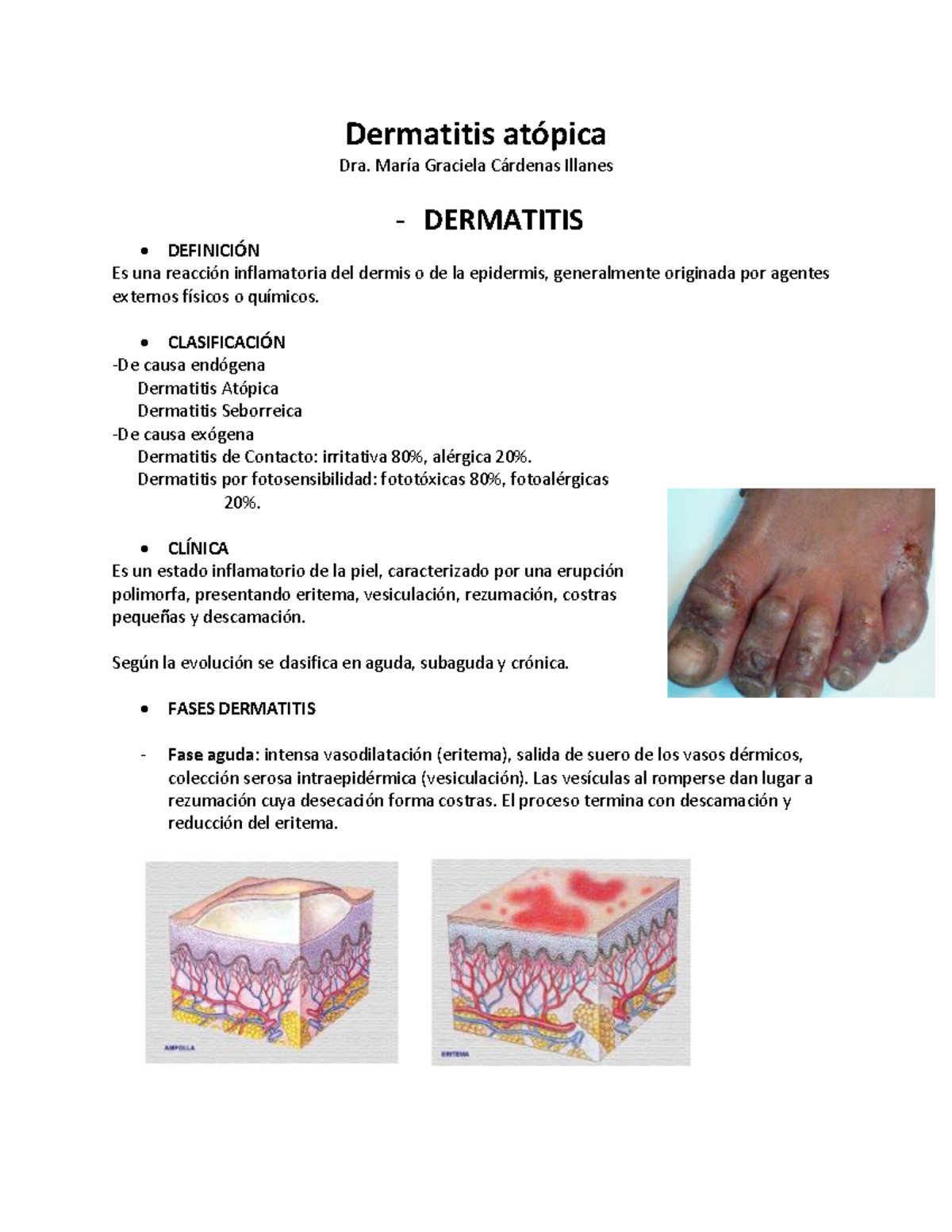 Dermatitis atópica - Dermatologia apuntes - Dermatitis atópica Dra ...