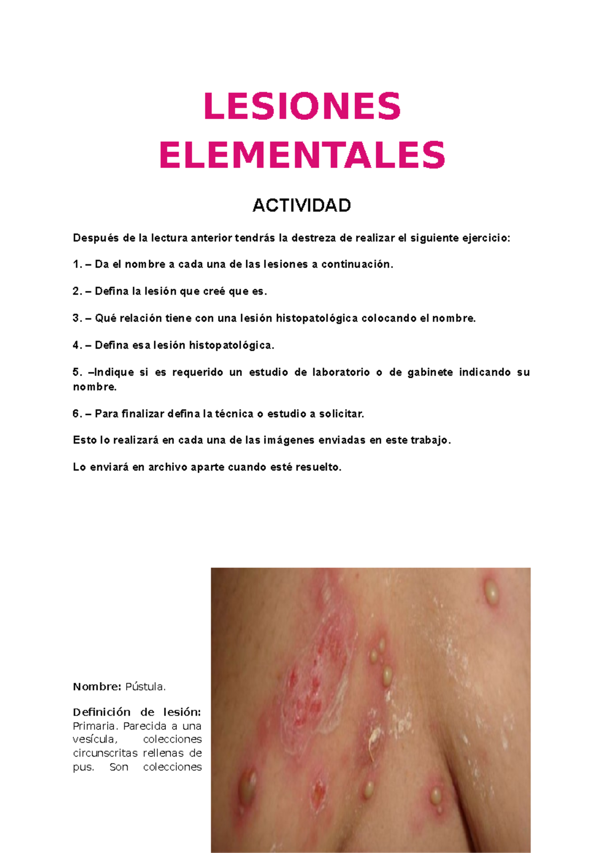 Lesiones - 1420 - LESIONES ELEMENTALES ACTIVIDAD Después de la lectura anterior tendrás la ...