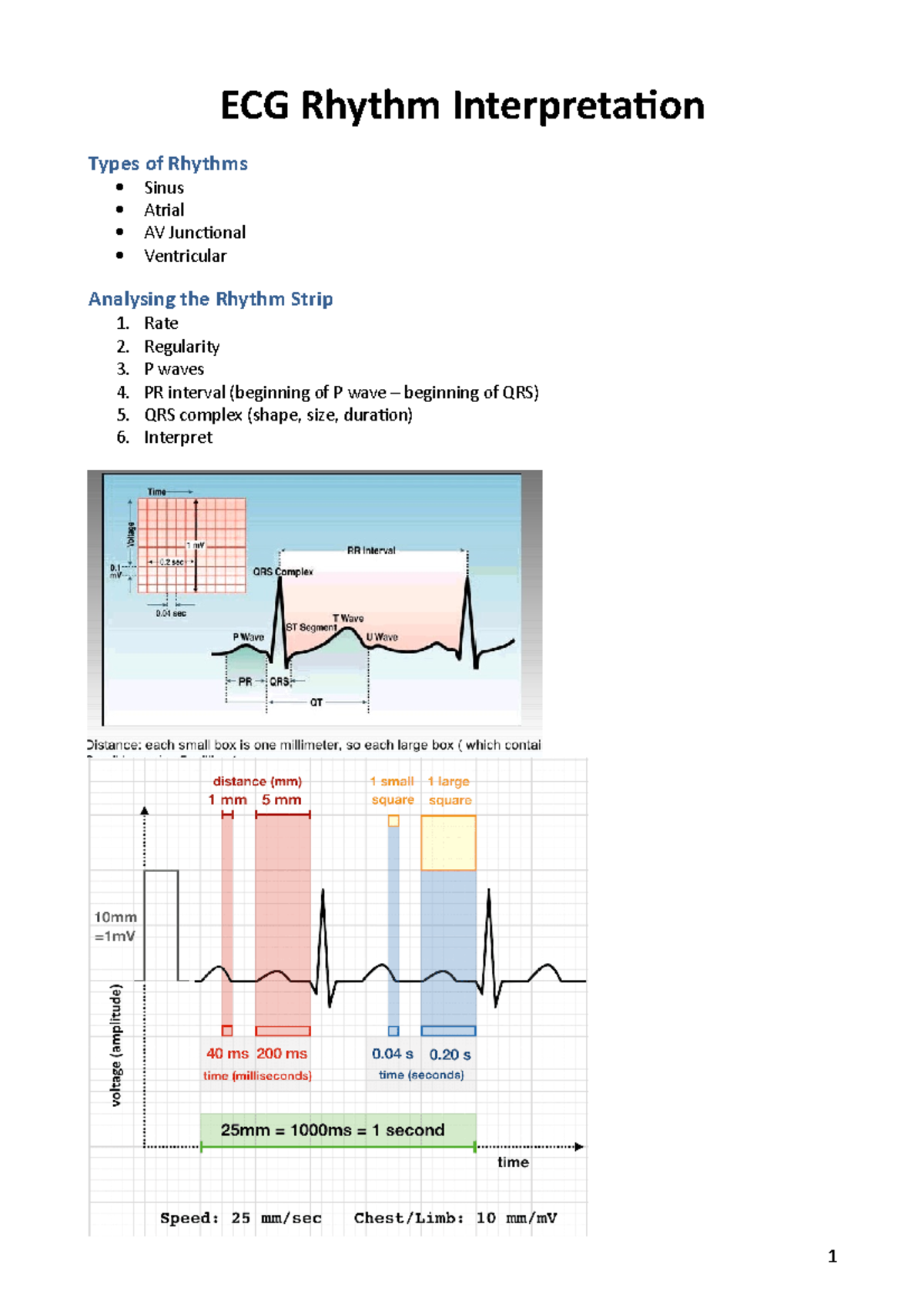 ECG Rhythm Interpretation - ECG Rhythm Interpretation Types of Rhythms Sinus Atrial AV - Studocu