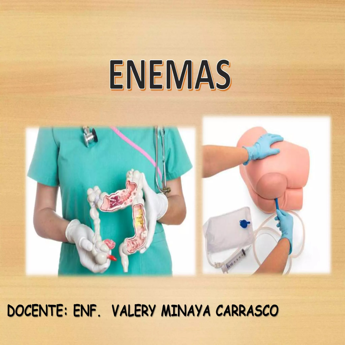 Enema tiposnde enema - ENEMAS DOCENTE: ENF. VALERY MINAYA CARRASCO ...