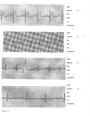 EKG Practice Strips 2 Answer Key - NRSE 4610 - ETSU - Studocu