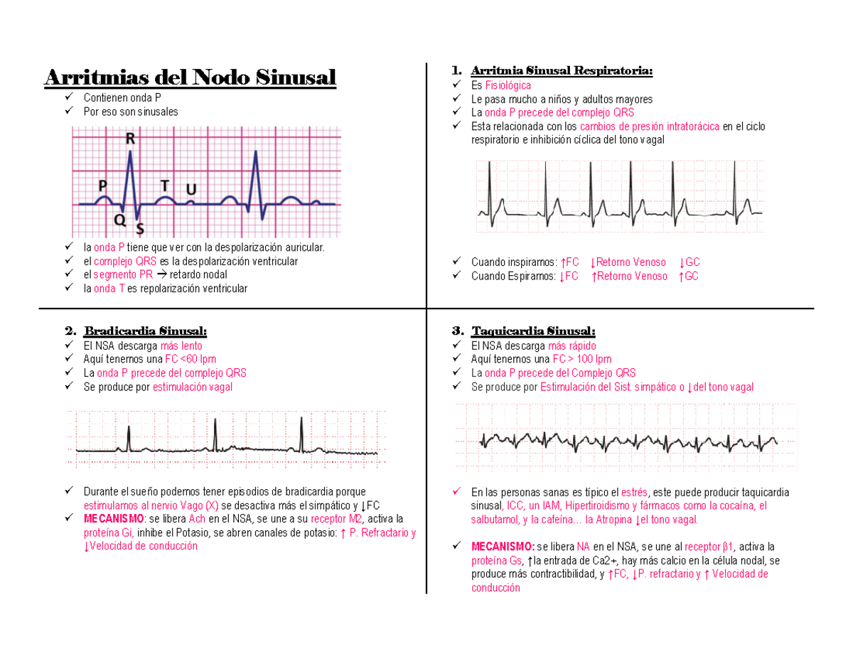 Arritmias del Nodo Sinusal - Warning: TT: undefined function: 32 ...