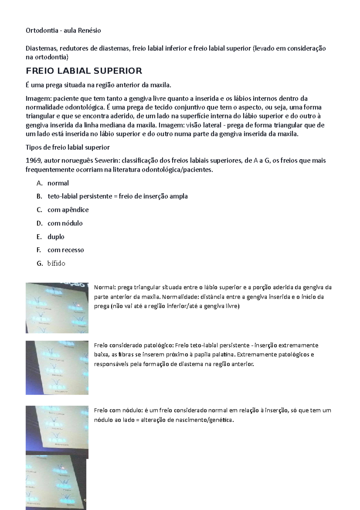 Aula 10 - Freio Labial Superior-Renésio - Ortodontia - aula Renésio ...