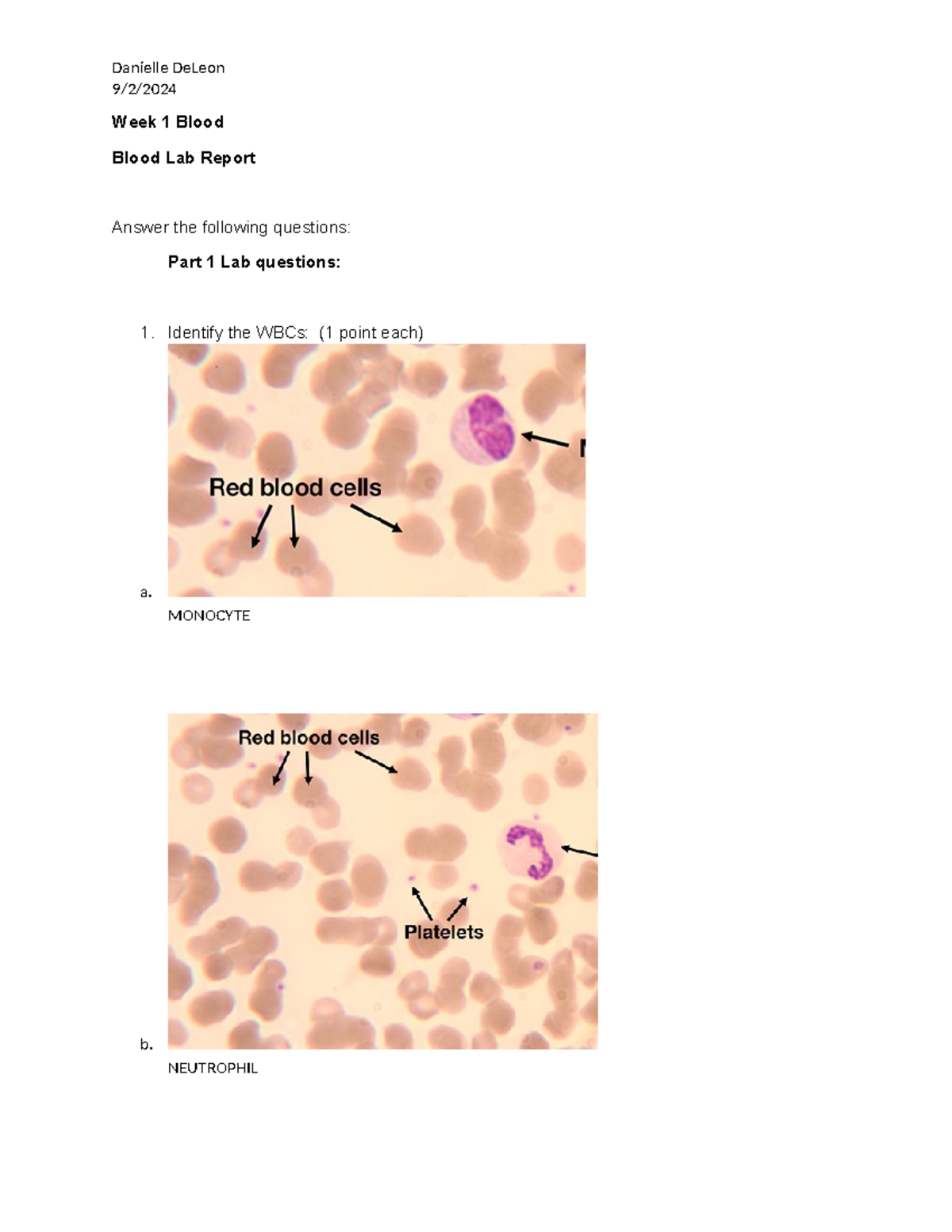 Lab Week 1 - lab report - Danielle DeLeon 9/2/ Week 1 Blood Blood Lab ...
