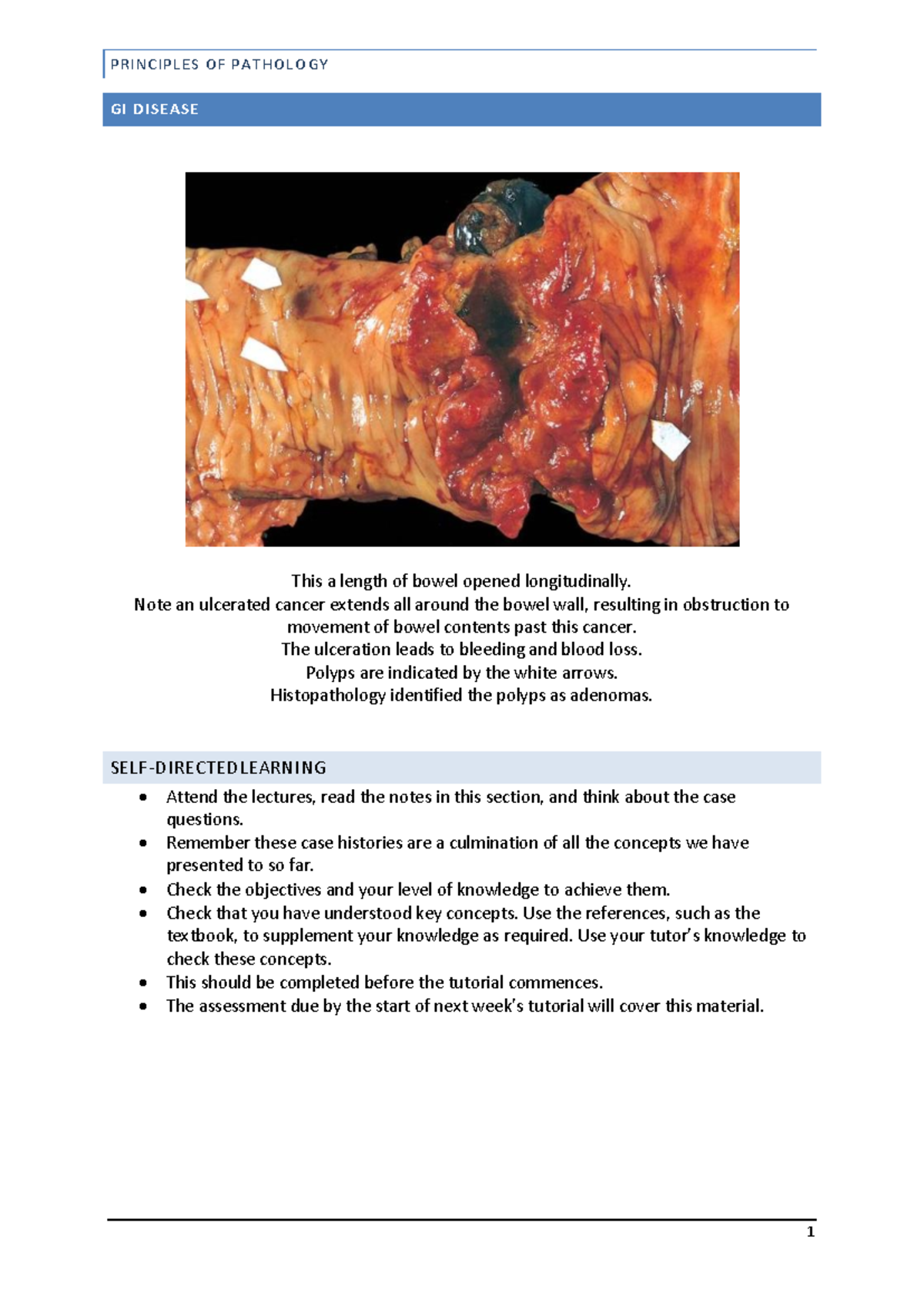 2022 GI Disease Worksheet - GI DISEASE This a length of bowel opened ...