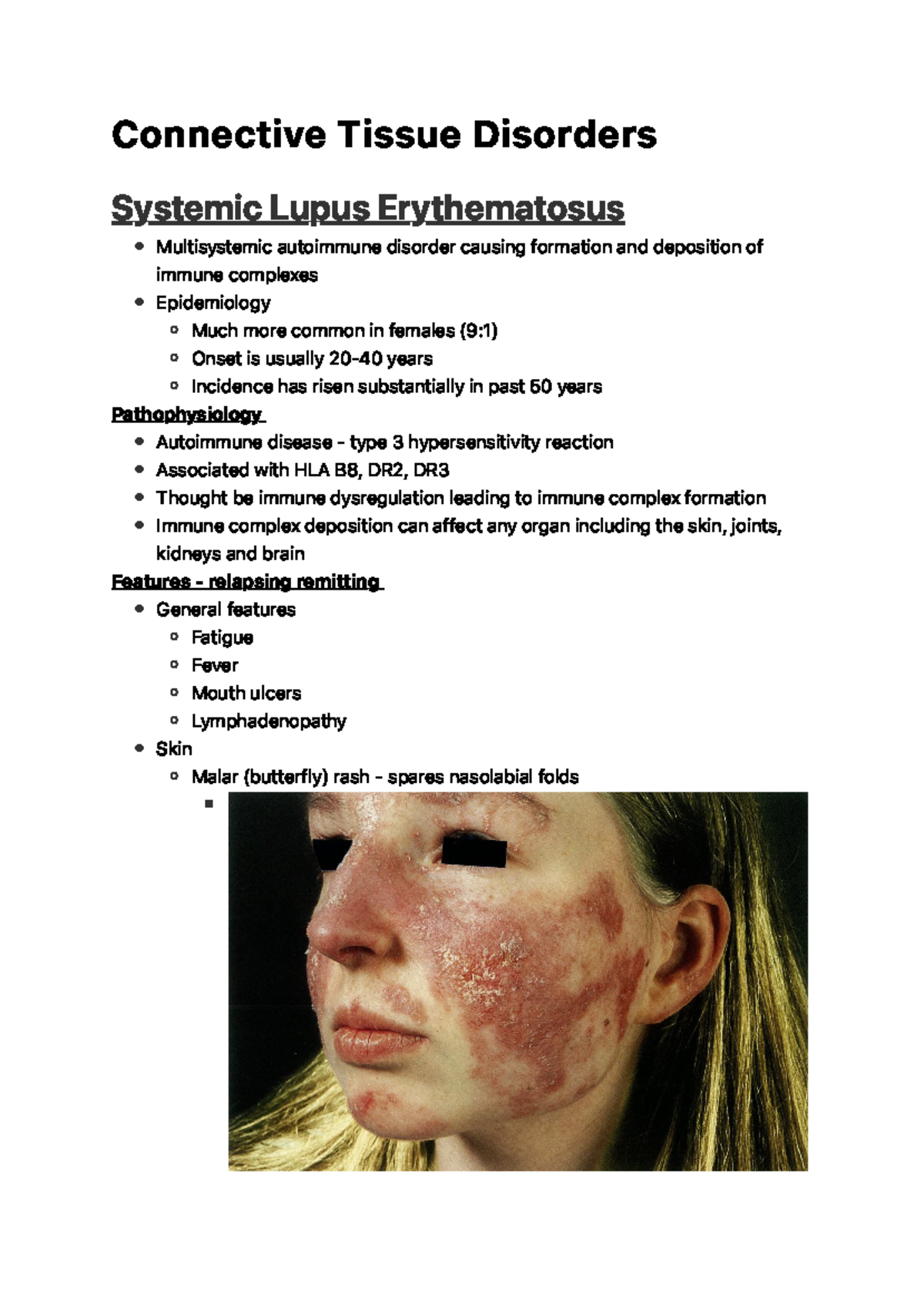 Connective Tissue Disorders - C o n n e c t i ve Ti ss u e D i s o rd e ...