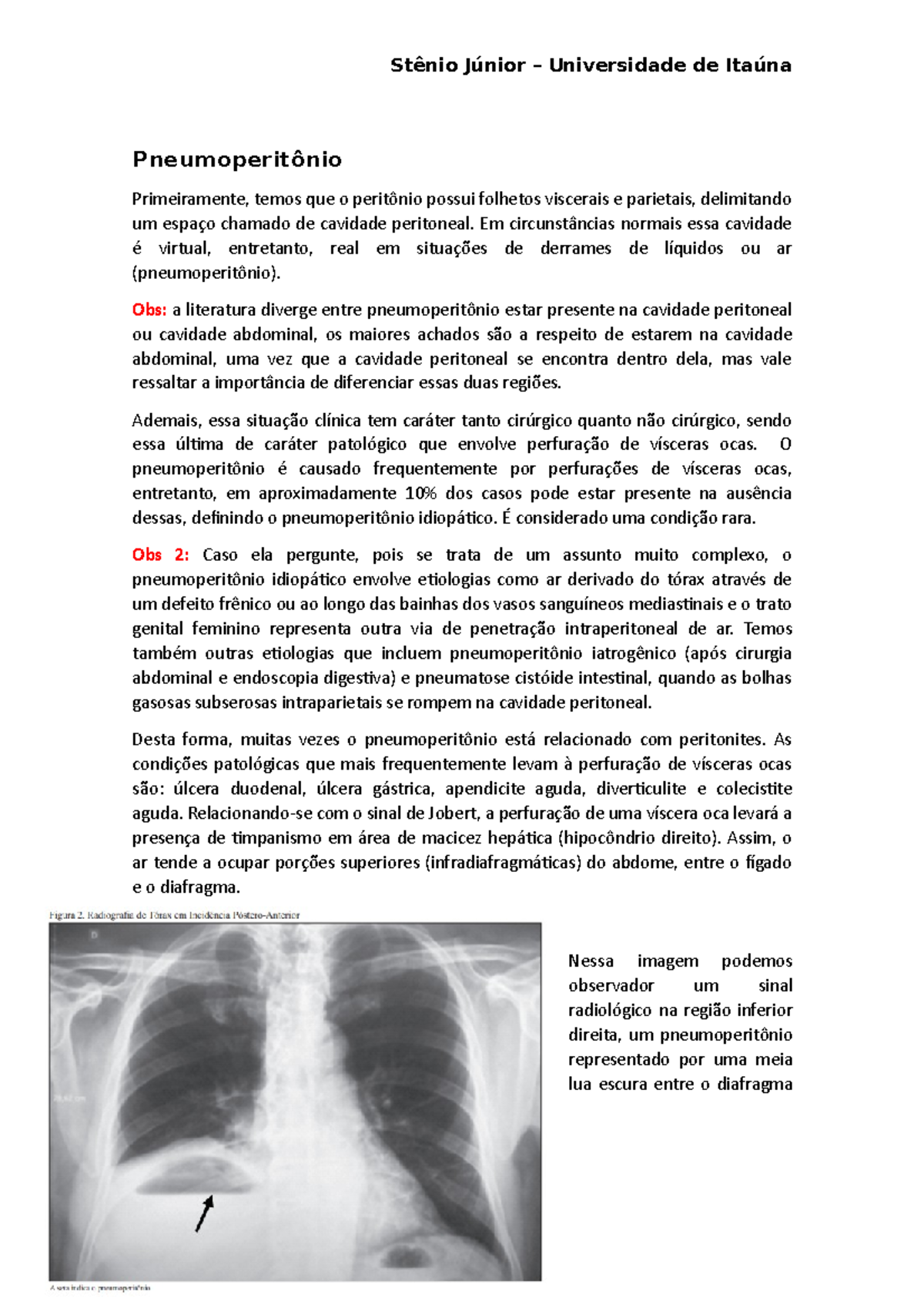 Pneumoperitônio - Stênio Júnior – Universidade de Itaúna ...