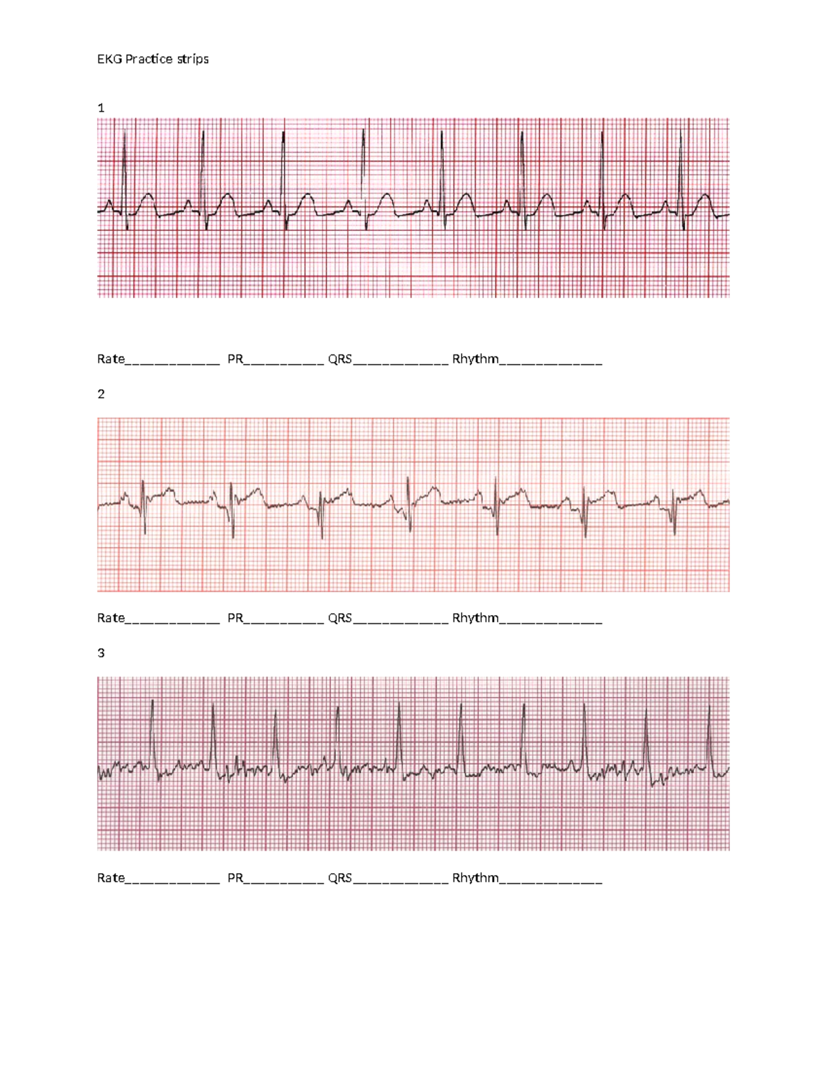 EKG PRACTICE QUESTIONS - 1 Rate_____________ PR___________ QRS ...