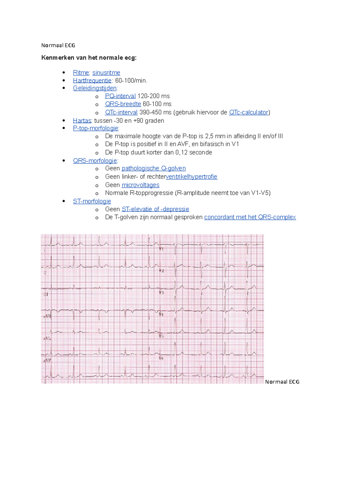 Normaal ECG - ECG uitleg , samenvattend met voorbeelden. ECG ...
