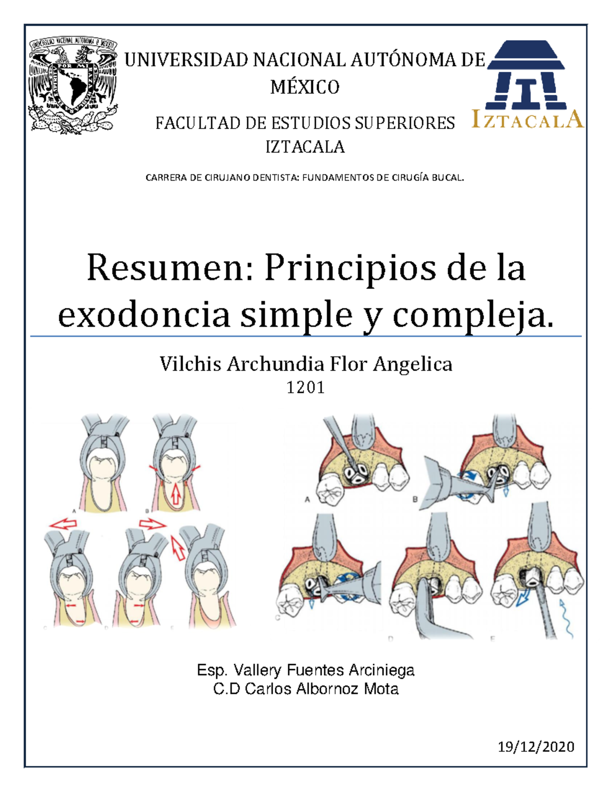 Resumen. Principios de la exodoncia simple y compleja - Cirugía Oral I ...