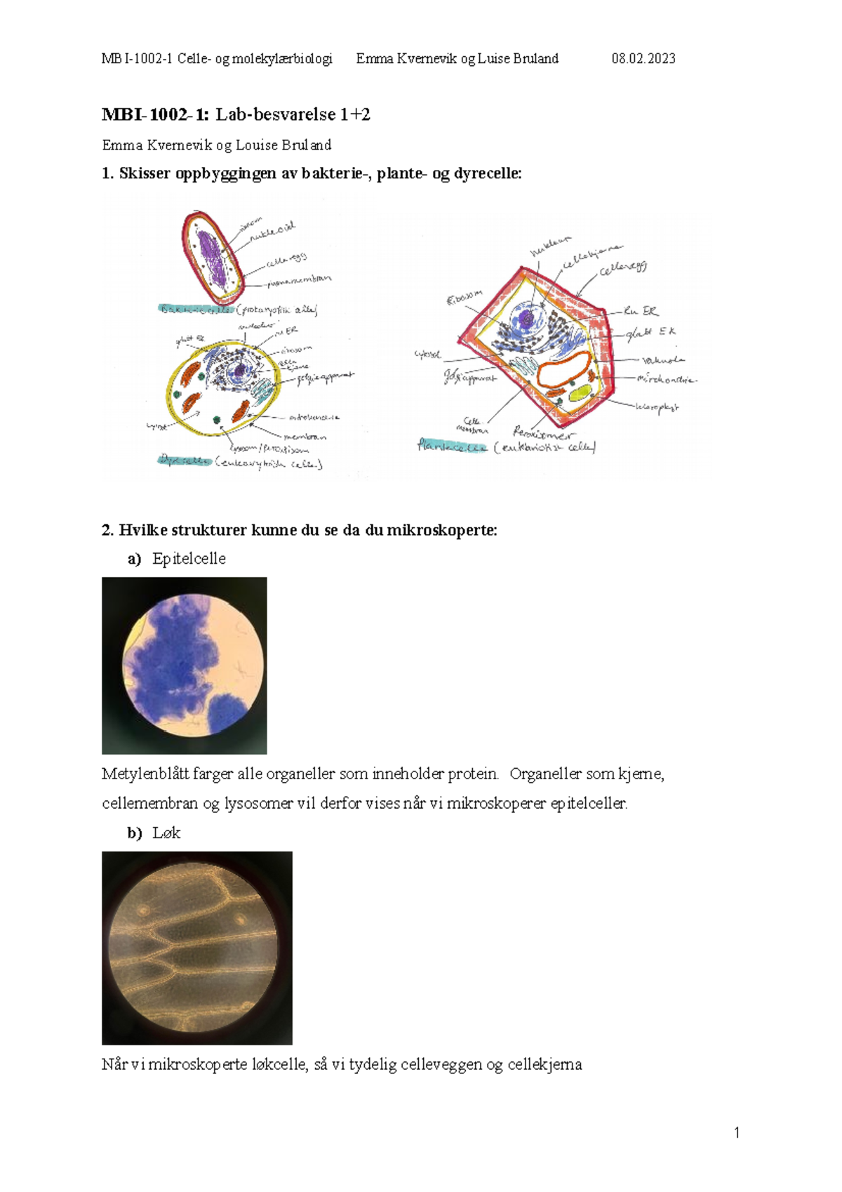 MBI-1002-1 Lab-besvarelse 1+2 godkjent - MBI-1002-1: Lab-besvarelse 1+ Emma Kvernevik og Louise ...