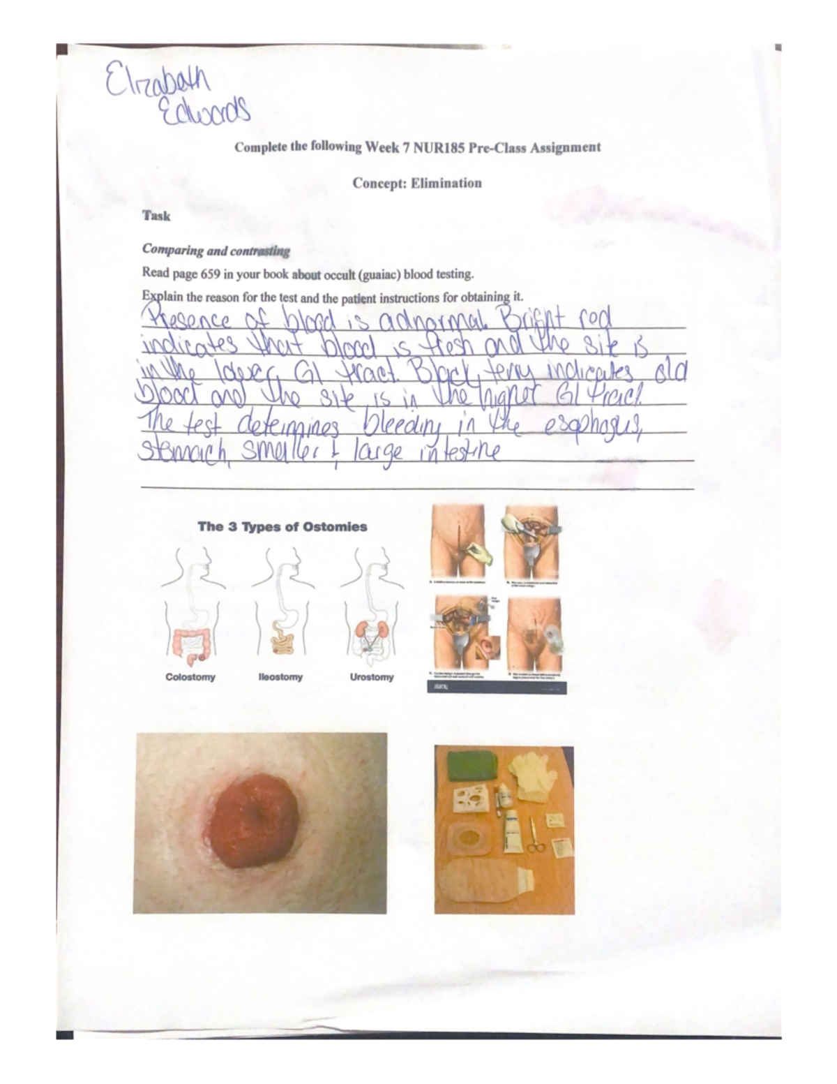 Complete the following Week 7 NUR185 Pre-Class Assignment - NUR 185 ...