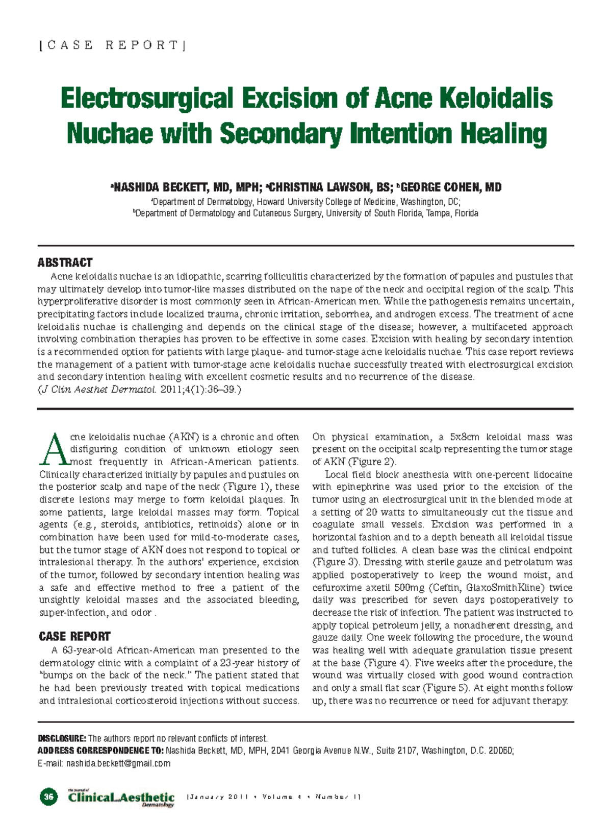 Electrosurgical Excision of Acne Keloidalis nuchae with sesondary ...