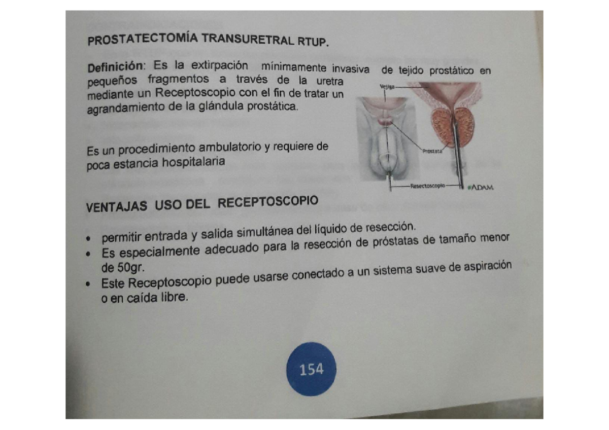 PDF Equipo Y Tratamientos Endoscopicos - PROSTATECTOMÍA TRANSURETRAL ...