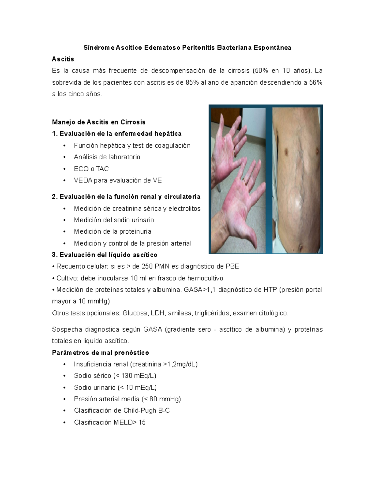 Síndrome Ascítico Edematoso Peritonitis Bacteriana Espontánea ...
