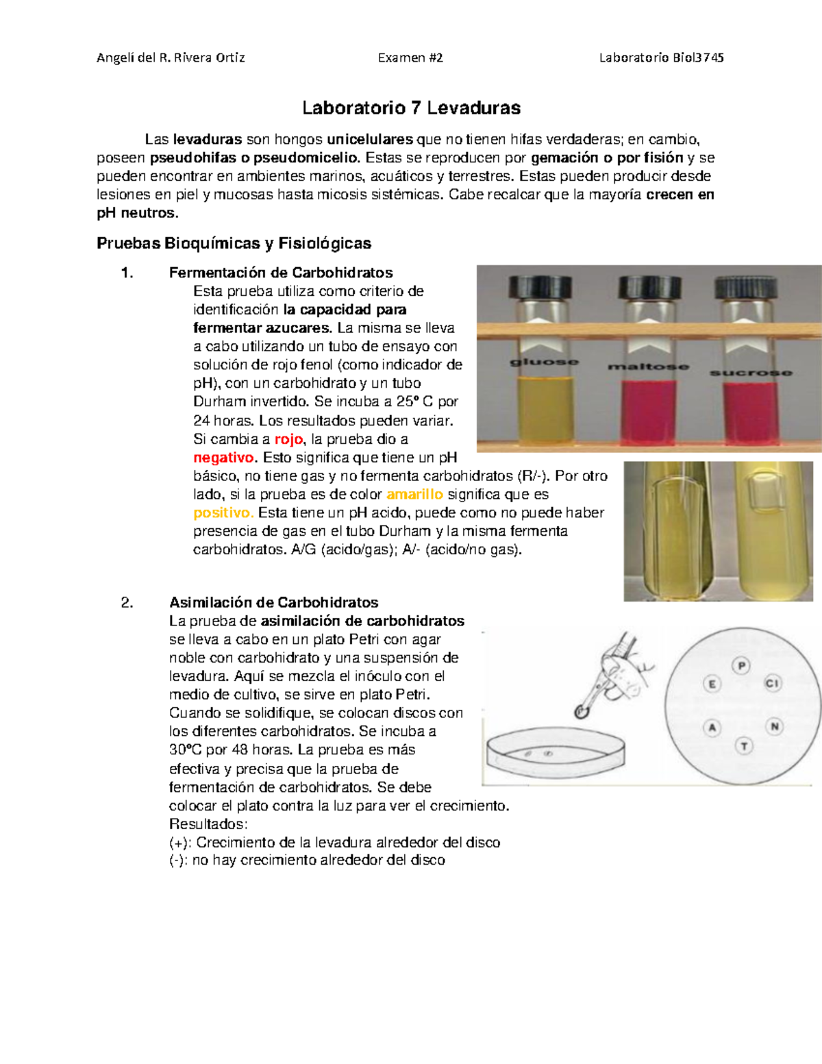 Repaso Examen Final Lab Mico Med - Laboratorio 7 Levaduras Las levaduras son hongos unicelulares ...