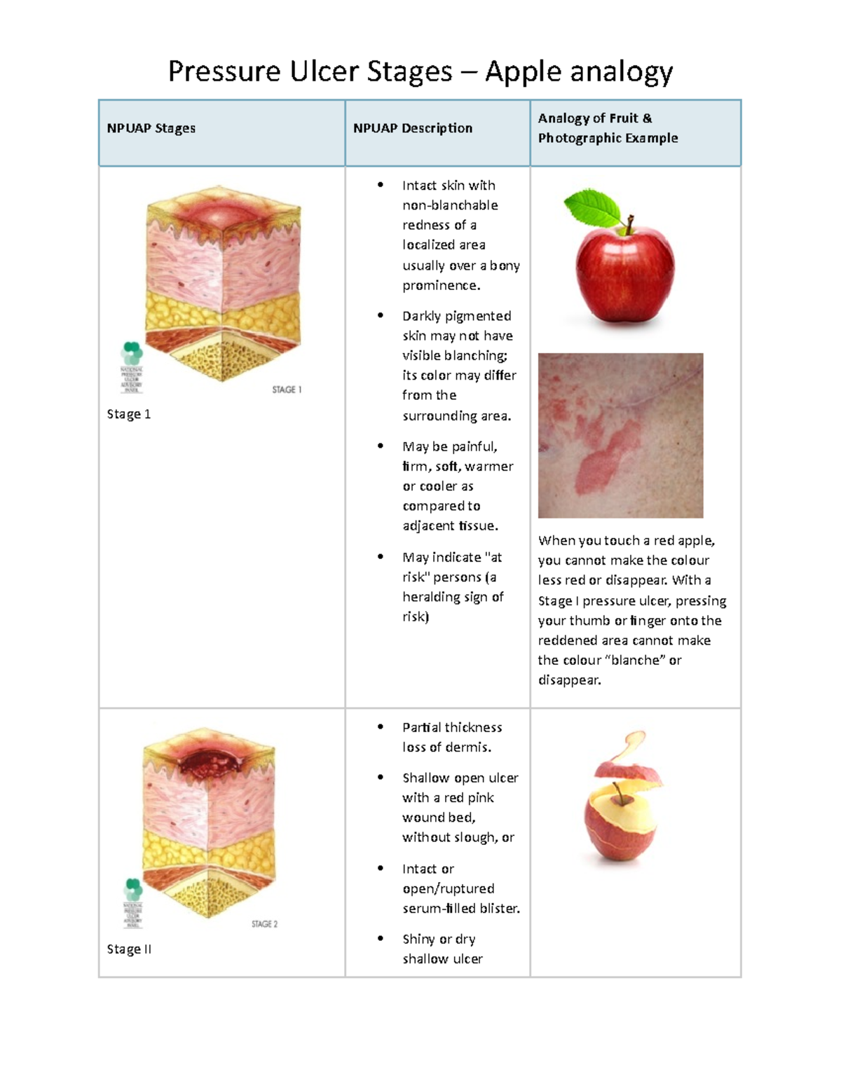 Ulcer Stages - review - NPUAP Stages NPUAP Description Analogy of Fruit & Photographic Example ...