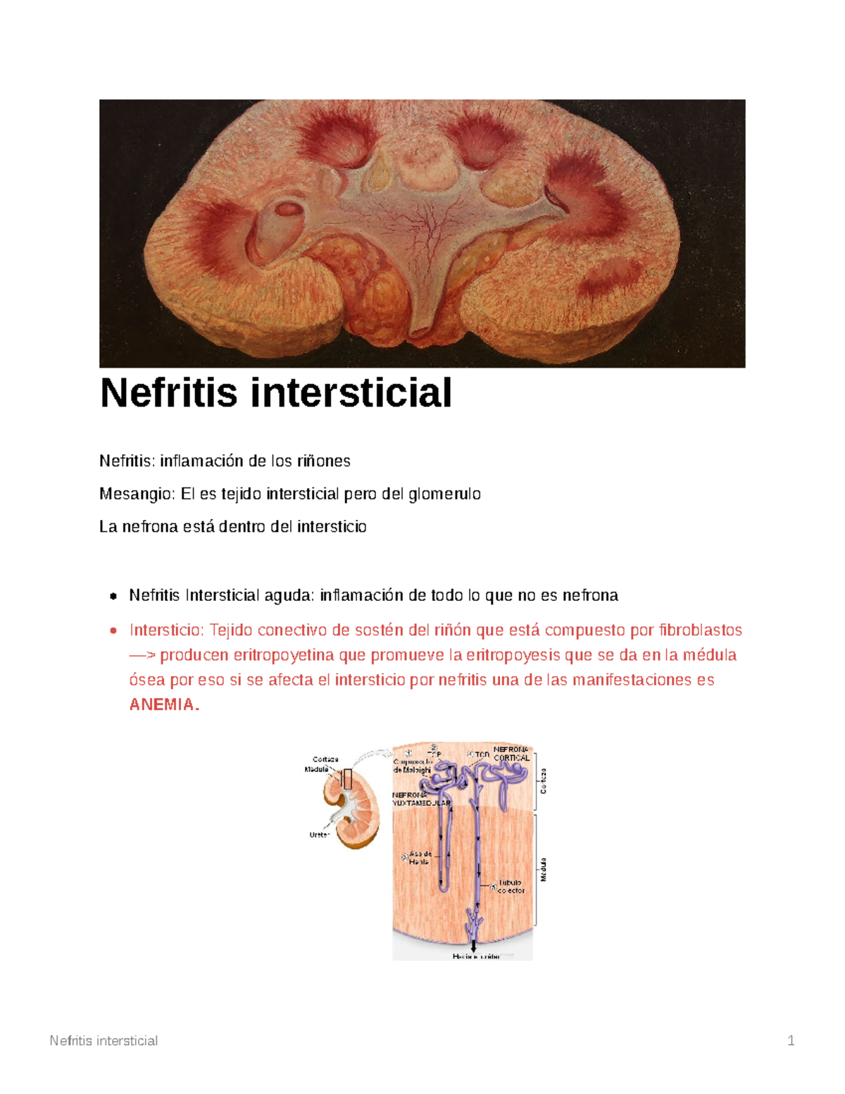 Clase Nefritis intersticial - Sistema Urinario y Renal - Uniandes - Studocu